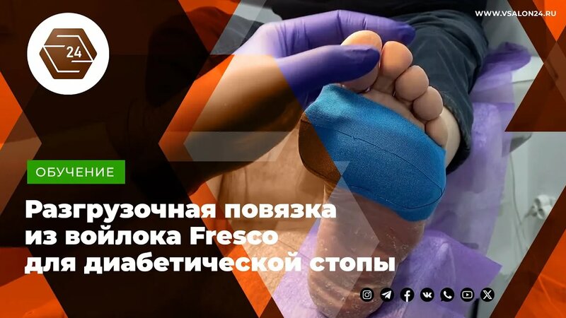 Разгрузочная повязка из войлока Fresco для диабетической стопы ...