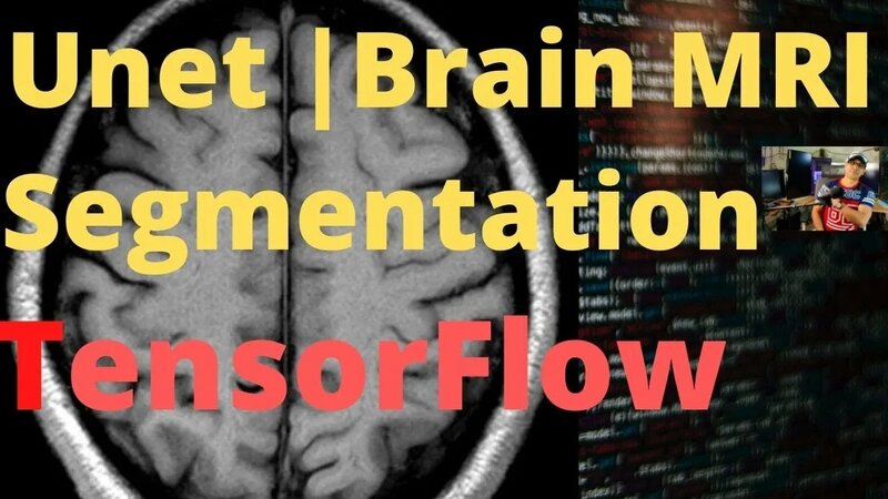 Unet Brain-MRI-Segmentation | TensorFlow | Computer Vision | Deep Learning | Kaggle | Medical ...