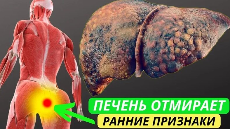 90 с проблемами Печени даже не знают об этом 14 ранних Признаков того что ваша Печень