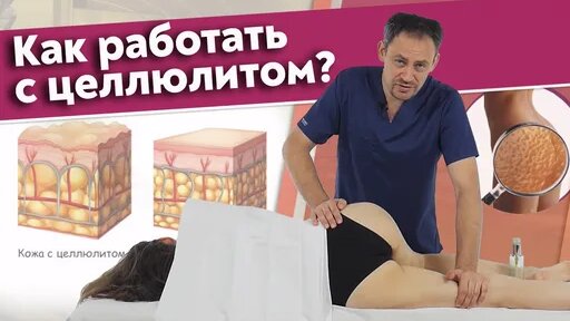 Как правильно работать с целлюлитом? Массаж против целлюлита на ...