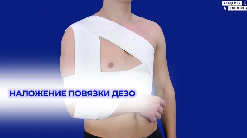 Наложение повязки Дезо - Видео от 311 МС Дистанционное обучение ...