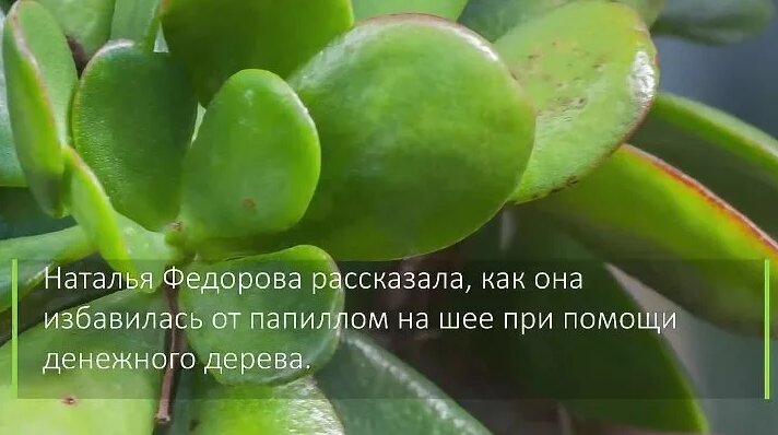 Папилломы на шее отвалятся сами. Как избавиться от папиллом в домашних ...