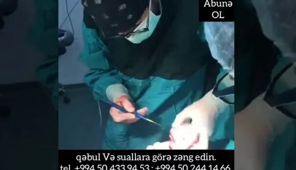 Op.Dr.Natiq Meherremov.-usaqliqinda boyuk Mioma olmasına baxmayaraq Ana Oldu.#trend#kesfet# ...