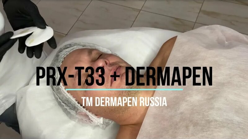 Протокол процедуры PRX-T33 и Дермапен DRA6 Premium. Правильное исполнение. - Смотреть онлайн в ...