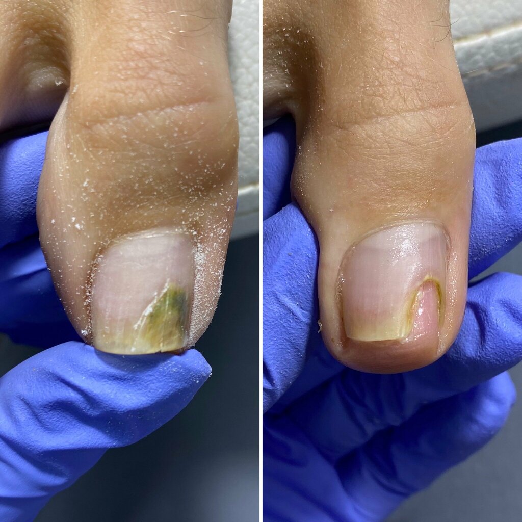 Podoloji Подология, Vladimir, foto