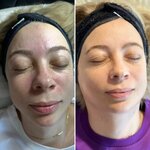 Dr. Aline_Cosmetolog (No:к219, Zelenograd), kozmetoloji, kozmetik salonları  Zelenograd'dan