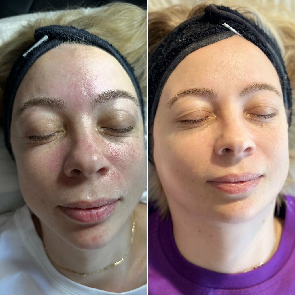 Kozmetoloji, kozmetik salonları Dr. Aline_Cosmetolog, Zelenograd, foto