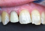Studio Dentistico Ballerin Dott. Ennio (Via Grazioli No:1, Trento), özel ağız ve diş sağlığı klinikleri ve muayenehaneleri  Trento'dan