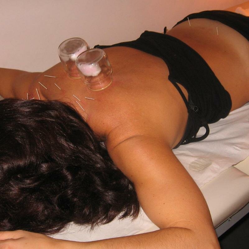 Alternatif tıp merkezleri Agopuntura Piastrelloni Dr. ssa Margherita, , foto