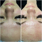 Sun_Beauty (Lobyrevskiy pereulok No:1), kozmetoloji, kozmetik salonları  Tula'dan