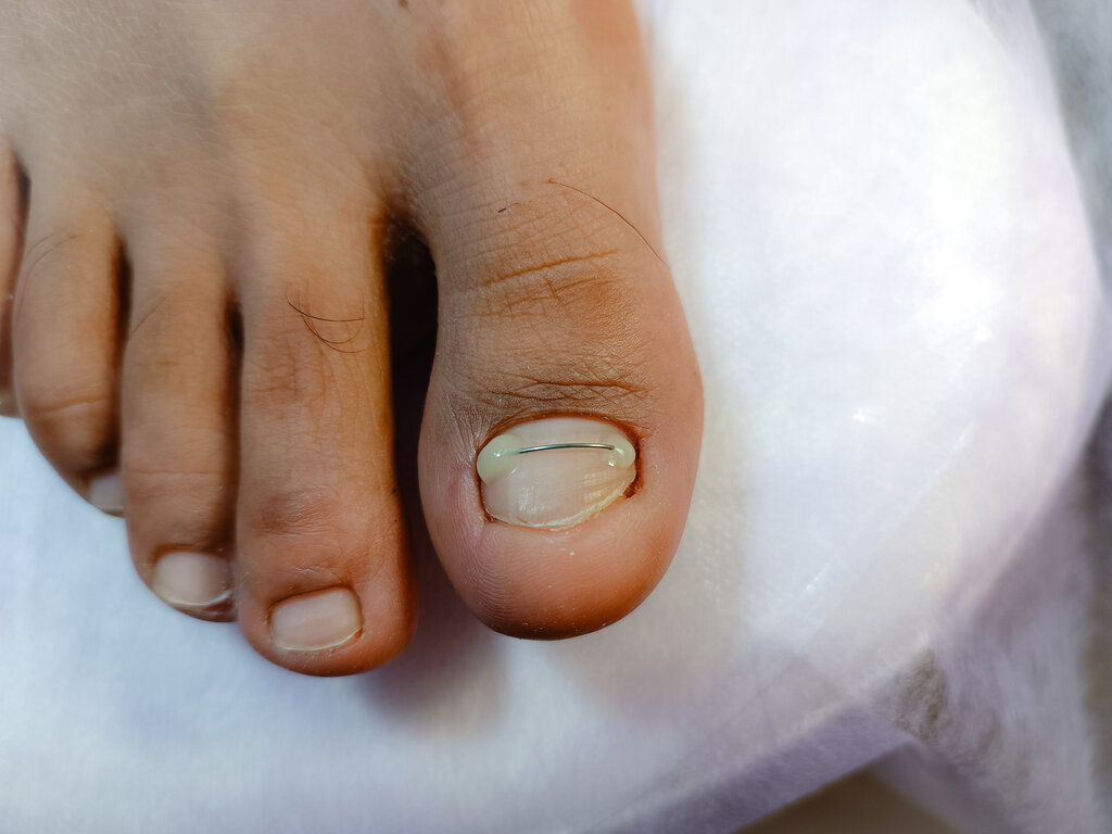 Podoloji Podolog Nadin, Kudrovo, foto