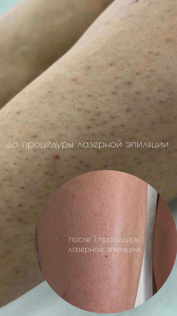 Kozmetoloji, kozmetik salonları SiriLab, Domodedovo, foto
