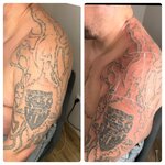 Лазерное удаление тату (No:8, 28th Quarter), dövmeciler  Achinsk'ten