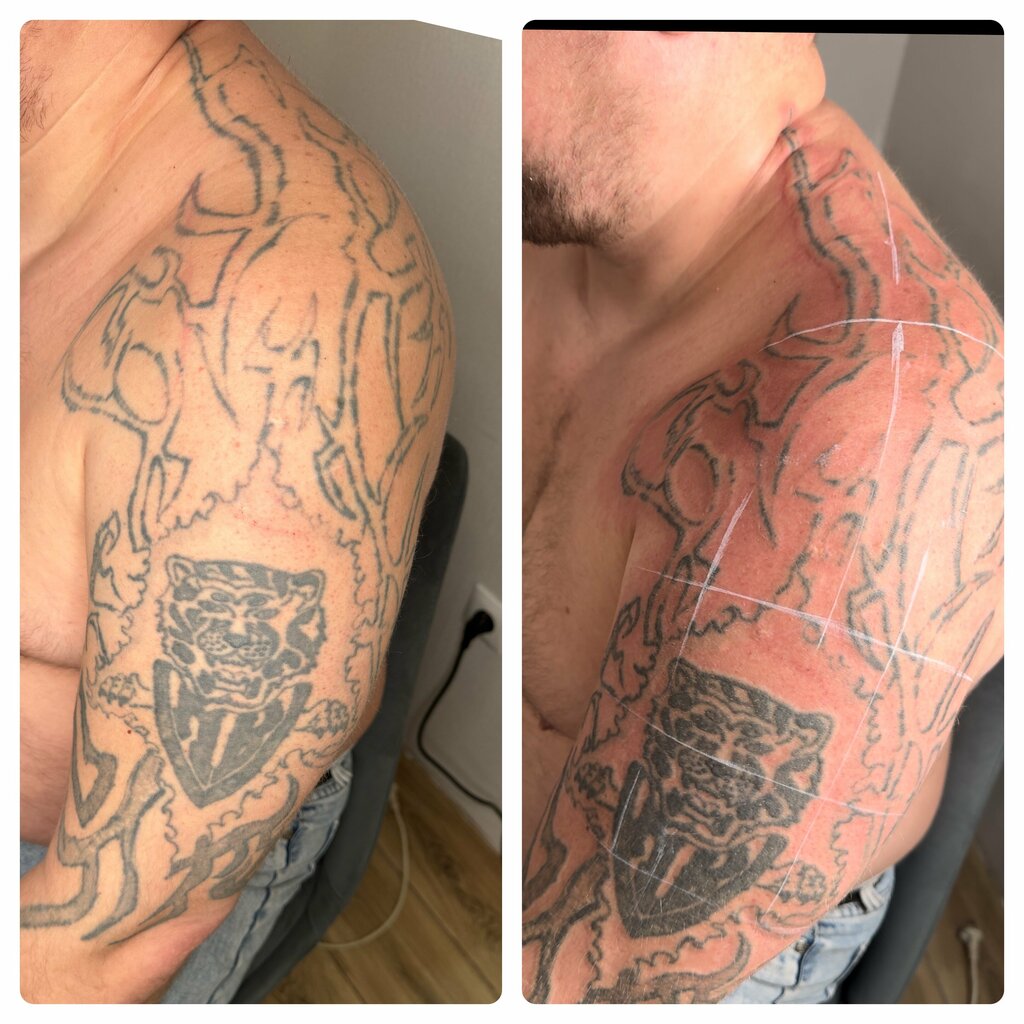 Dövmeciler Лазерное удаление тату, Achinsk, foto