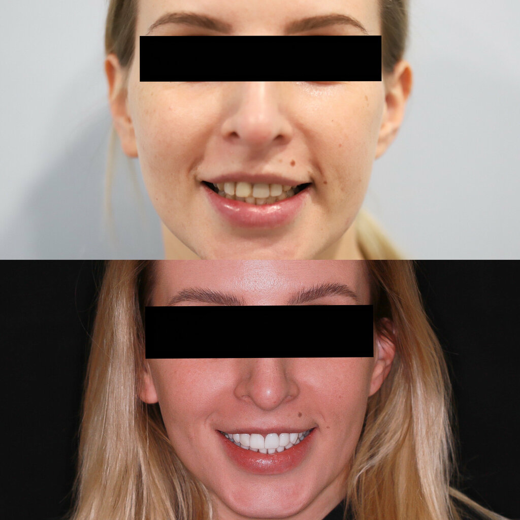 Diş laboratuvarı Brilliant smile lab, Moskova, foto