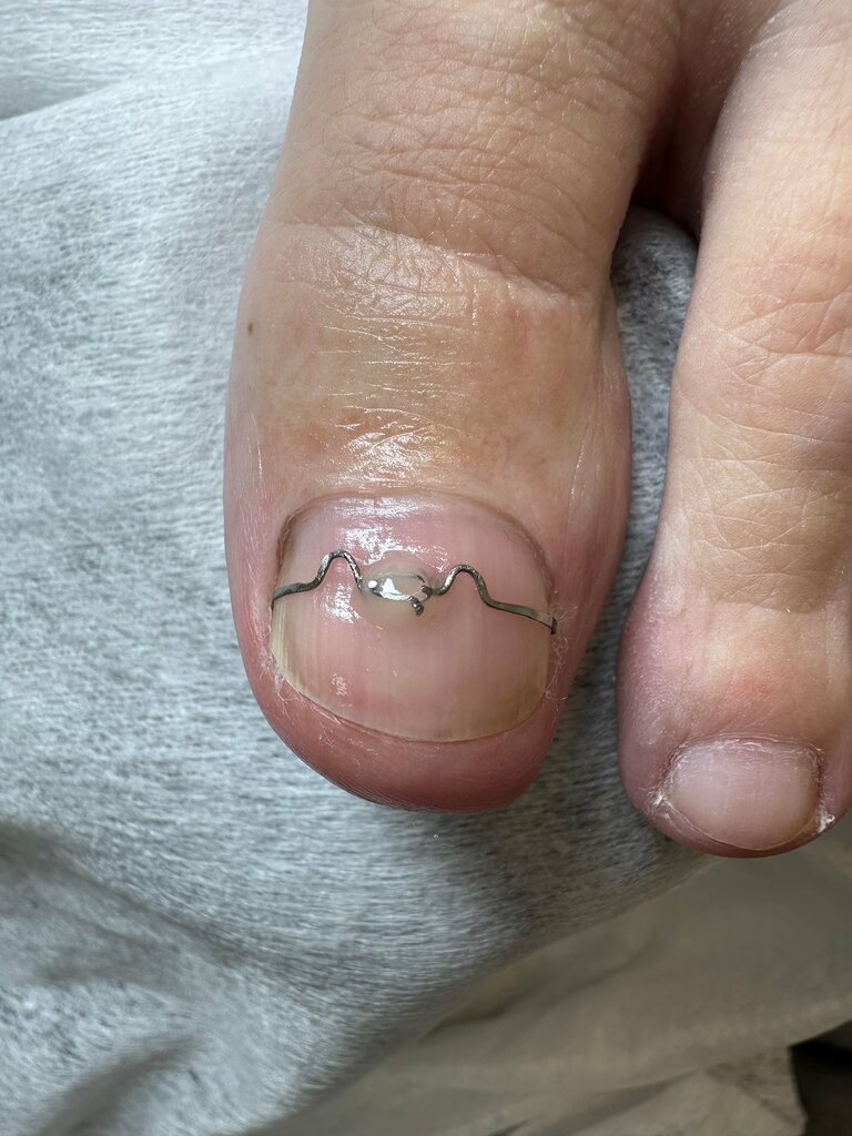 Podoloji Diamondfeet_ykt, Yakutsk, foto