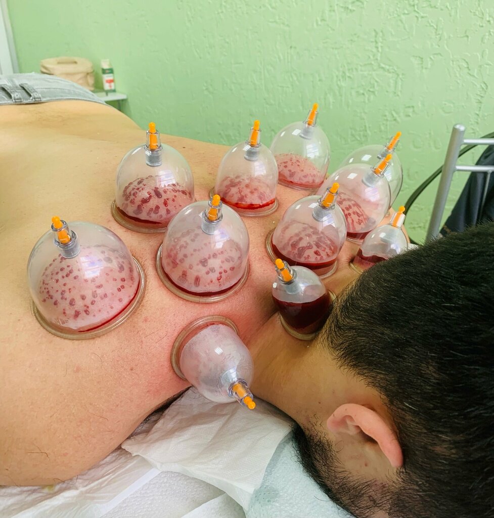 Masaj salonları Hijama, Nijni Novgorod, foto