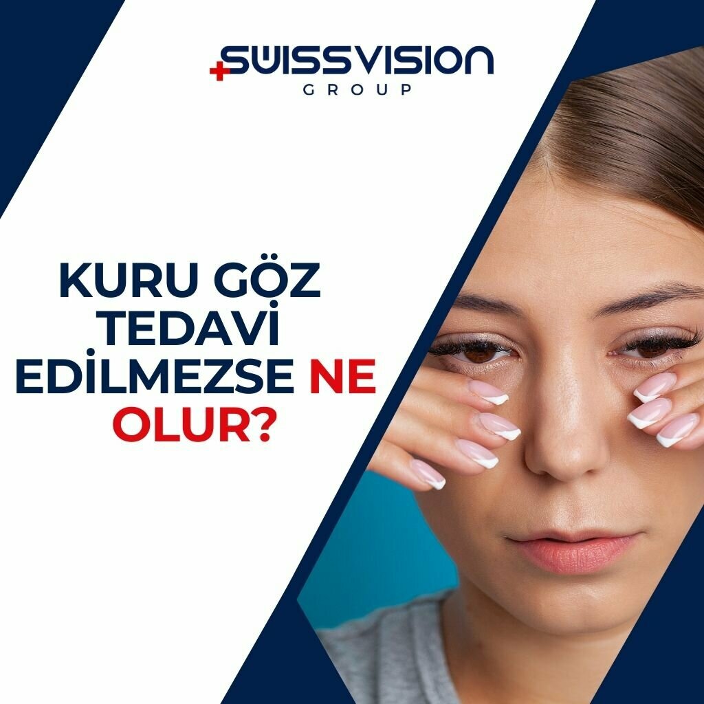 Göz sağlığı merkezleri Swiss Vision Group, İstanbul, foto
