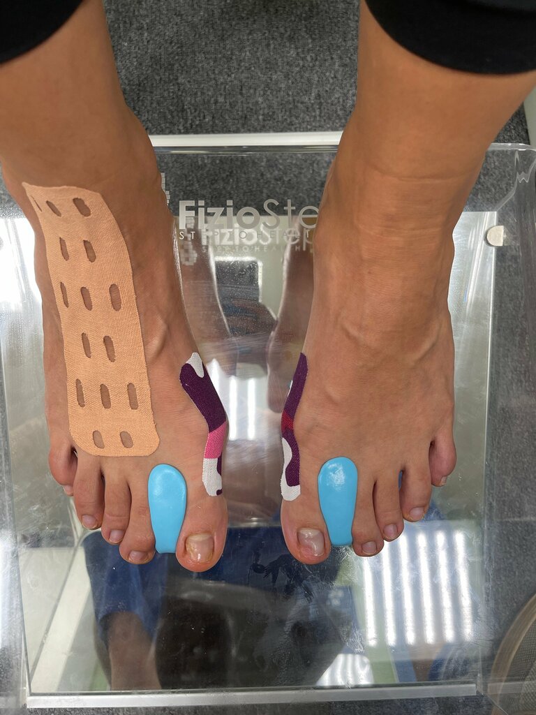 Protez yapımı Customized Ortho Insoles, Kazan, foto