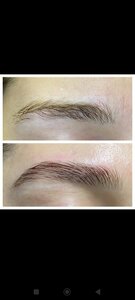 Dr. Çağnur Özcanlı Dermatoloji ve Kozmetoloji Kliniği (Kuşkavağı, Arden Plaza, 563. Sk. 7 Kat:4 Konyaaltı Antalya, Тurkiye), kaş ve kirpik salonu  Antalya'dan