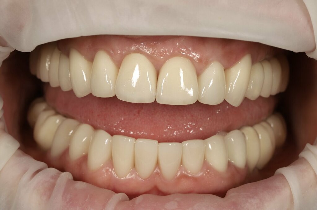 Özel ağız ve diş sağlığı klinikleri ve muayenehaneleri Dental clinic Avanstom, Moskova, foto