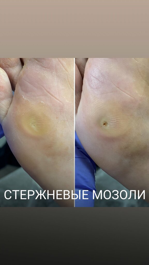 Podoloji Подология, Vladimir, foto