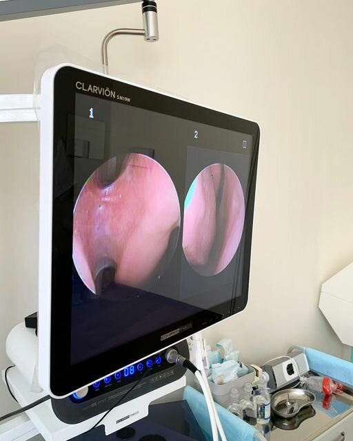 Özel muayenehaneler Лор-врач, Aktav, foto