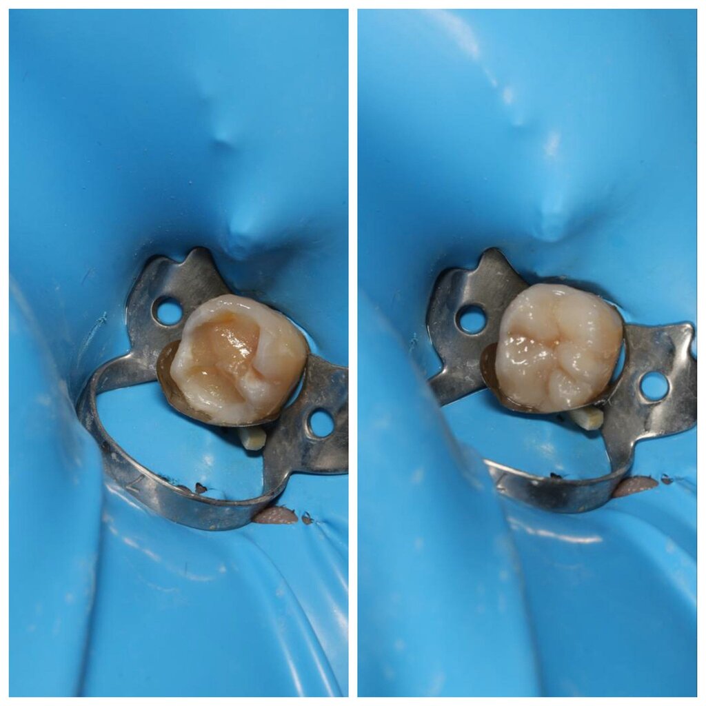 Özel ağız ve diş sağlığı klinikleri ve muayenehaneleri Dental clinic Avanstom, Moskova, foto