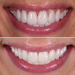 Apa Aesthetics Dental (63, Al Thanyah Street, Jumeirah, Dubai), özel ağız ve diş sağlığı klinikleri ve muayenehaneleri  Dubai'den