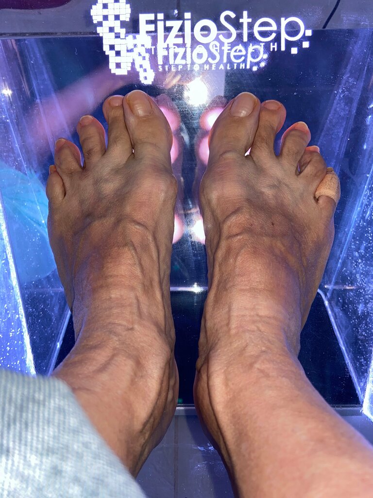 Protez yapımı Customized Ortho Insoles, Volzhsk, foto