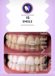IQ Smile (Projected Drive 4062 No:6), kozmetoloji, kozmetik salonları  Moskova'dan