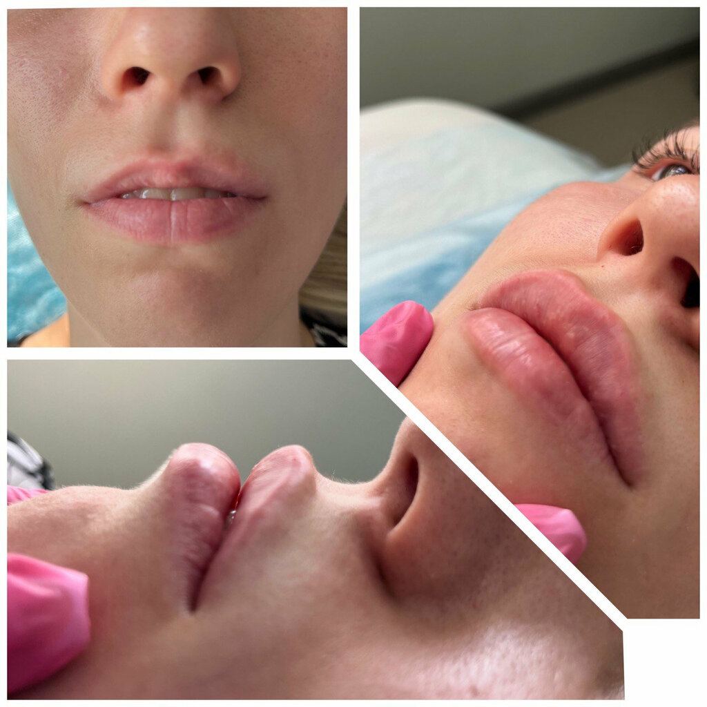 Kozmetoloji, kozmetik salonları Нектарин, Kemerovo, foto