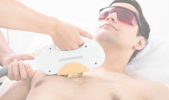 Epilasyon DermoPark Eskişehir Erkek Lazer Epilasyon, Eskişehir, foto