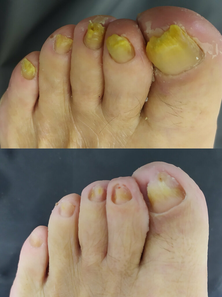 Uzman hizmetleri Подолог Карасёва А. А., Kırım Cumhuriyeti, foto