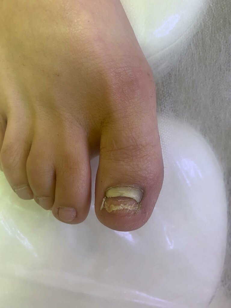 Podoloji Picasso, Ufa, foto