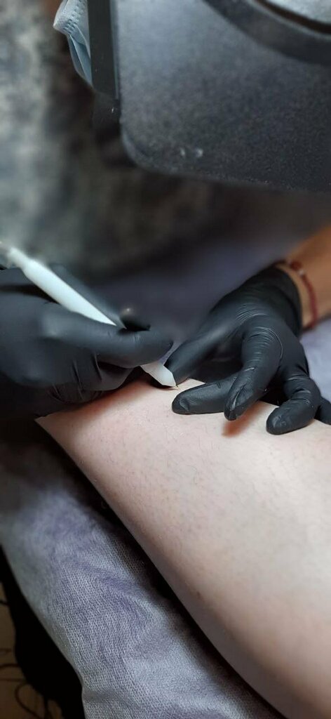 Epilasyon Avrutina. epil, Moskova ve Moskovskaya oblastı, foto