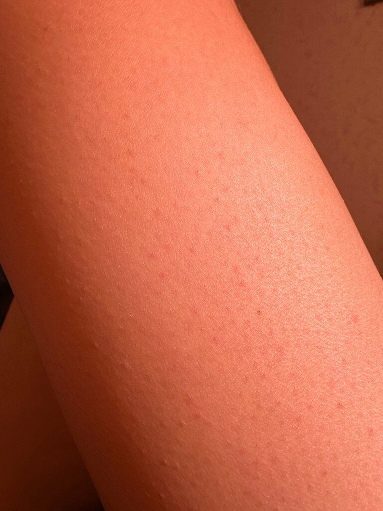 Epilasyon Sugar. leri, Nijni Novgorod, foto