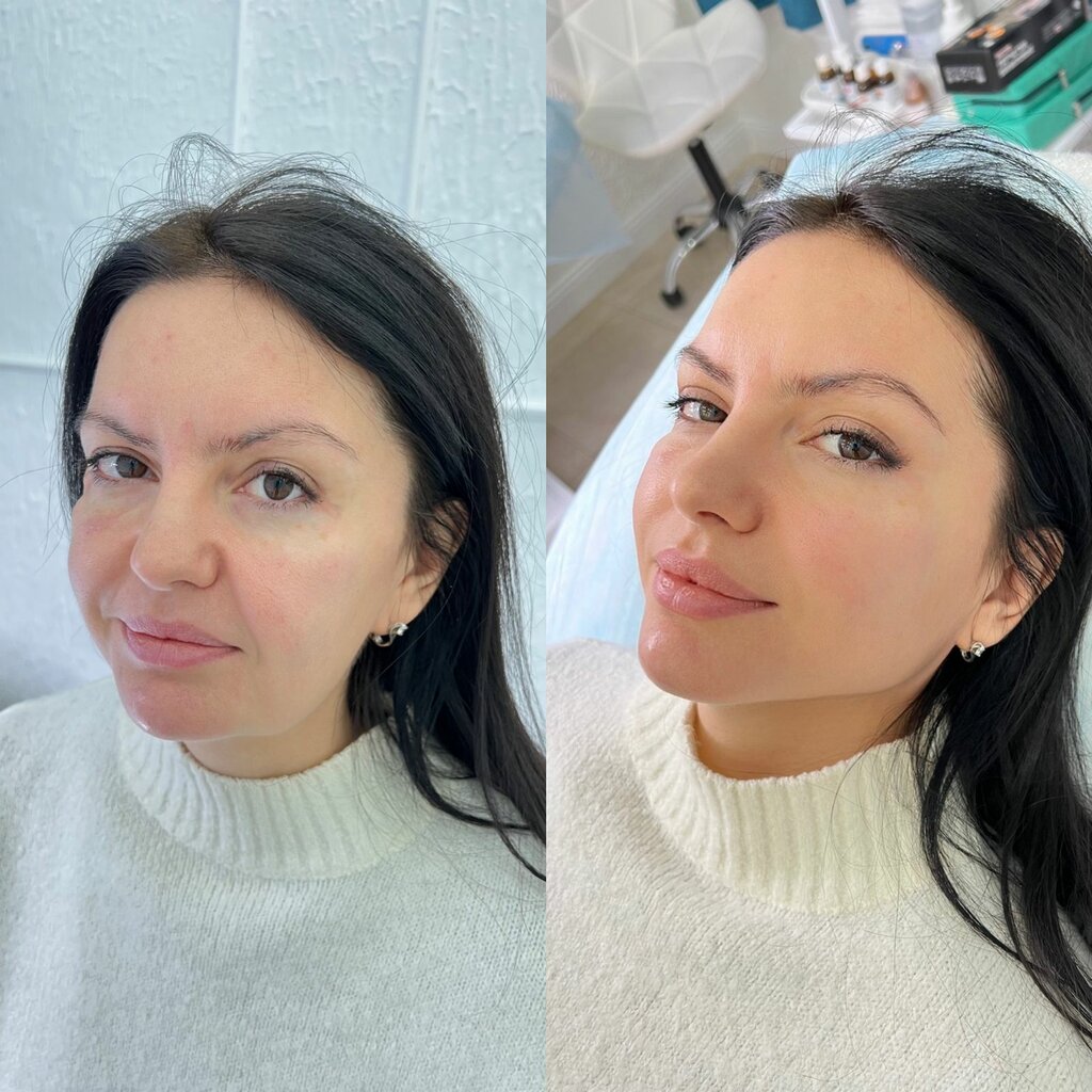 Kozmetoloji, kozmetik salonları Dr. Teri, Moskova, foto