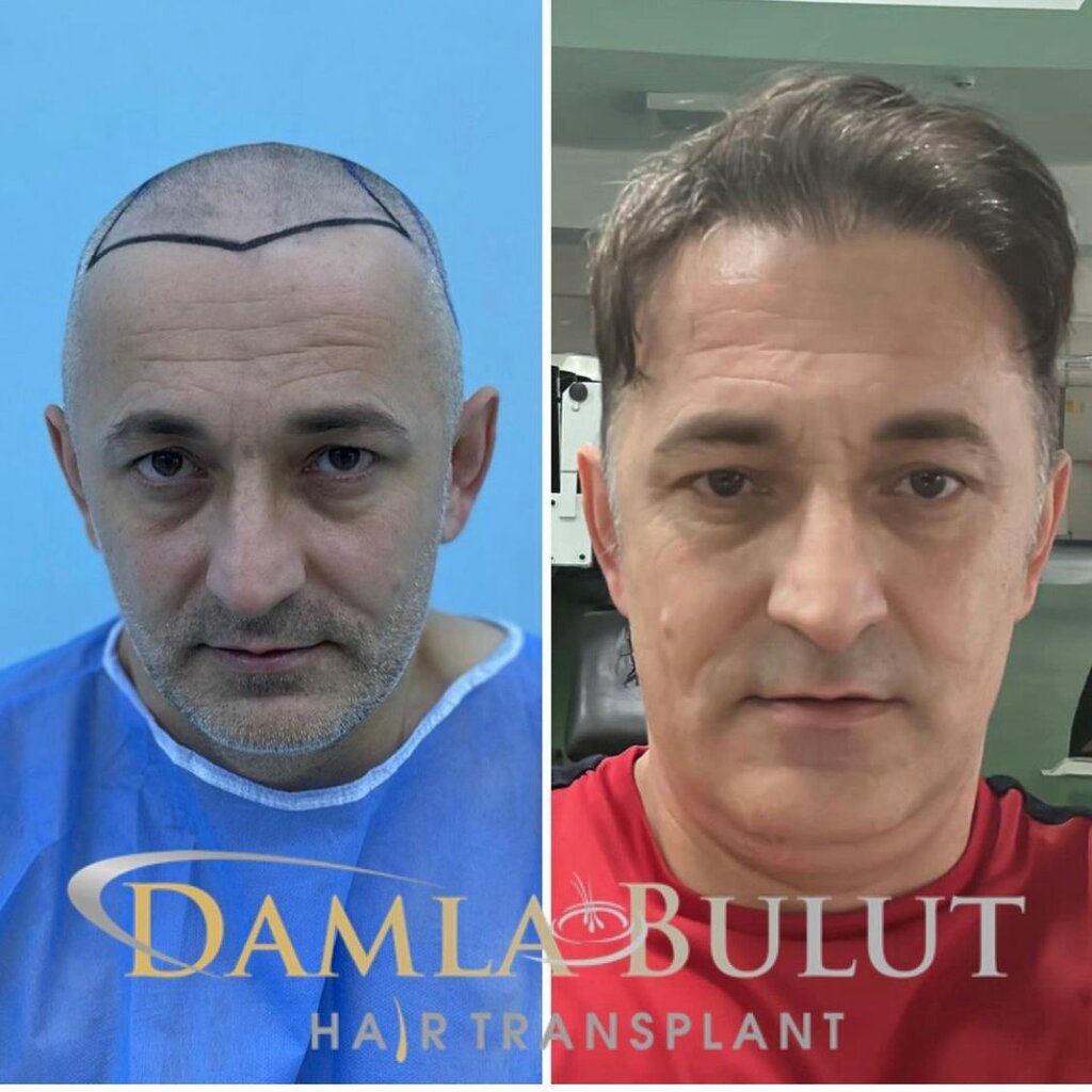 Tıp merkezleri ve klinikler Damlabuluthairtrans Saç Ekim Kliniği, Arnavutköy, foto