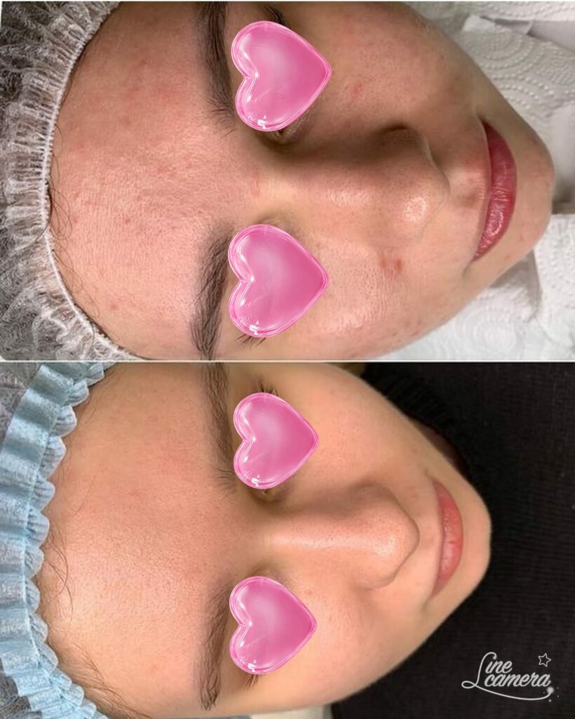 Kozmetoloji, kozmetik salonları Beauty Std, Rostov‑na‑Donu, foto