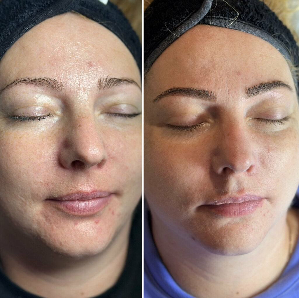 Kozmetoloji, kozmetik salonları Dr. Aline_Cosmetolog, Zelenograd, foto