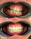 Zirve Dental Ağız Ve Diş Sağlığı Polikliniği (Aydın, Didim, Altınkum Mah., Karakol Cad., 3/1), özel ağız ve diş sağlığı klinikleri ve muayenehaneleri  Didim'den