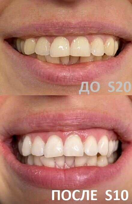 Kozmetoloji, kozmetik salonları ArtSmile studio, Sevastopol, foto