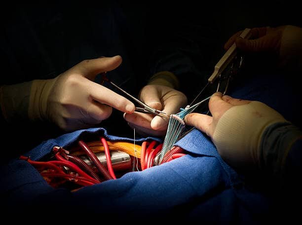 Hastaneler Dr. Benjo Gareca Villalpando - Cardiovascular Surgery garecor, Cochabamba, foto