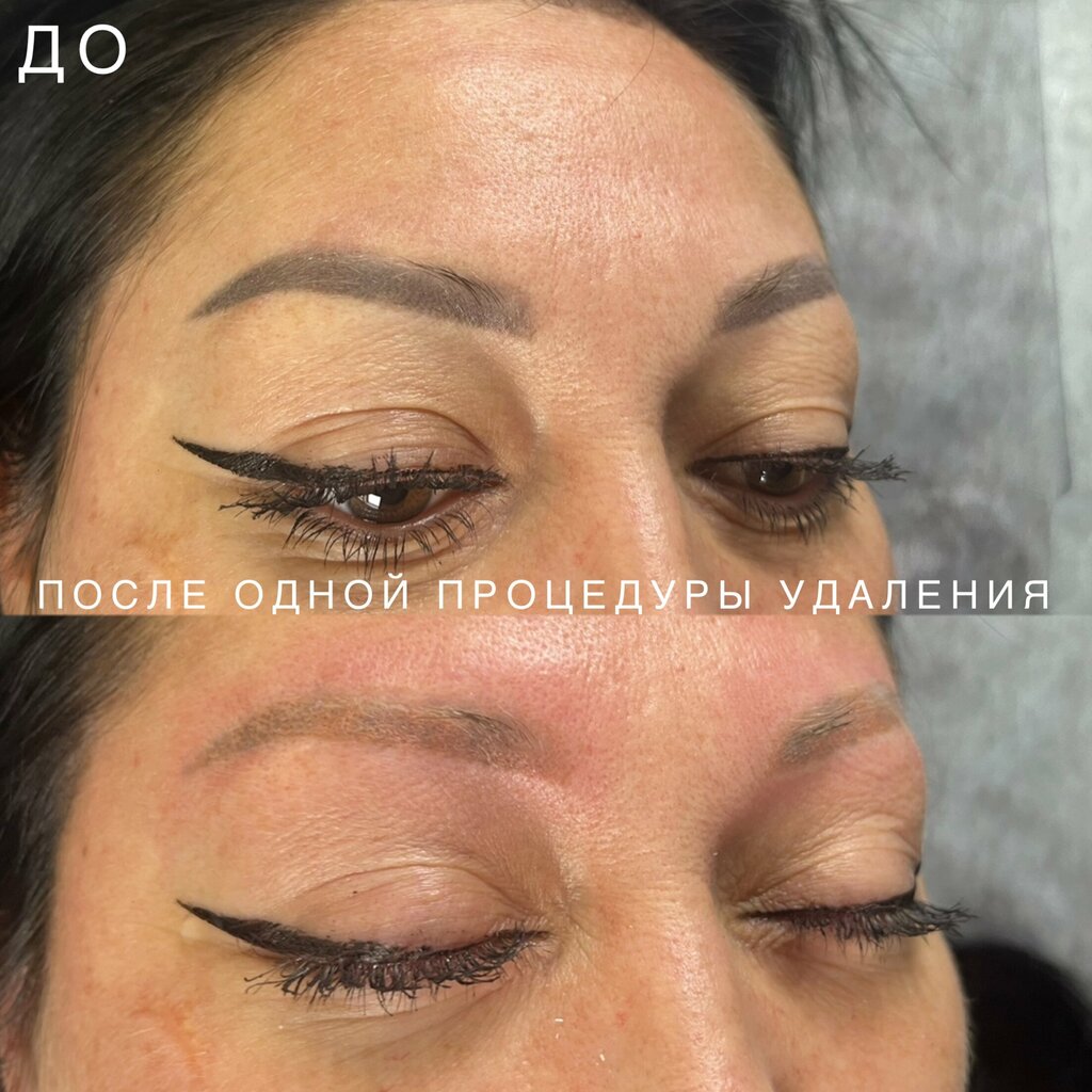 Kozmetoloji, kozmetik salonları Studio_laser, Samara, foto