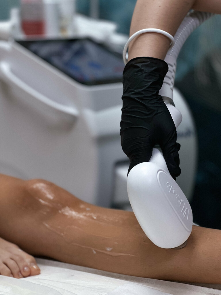 Epilasyon Easy Slip, Yekaterinburg, foto