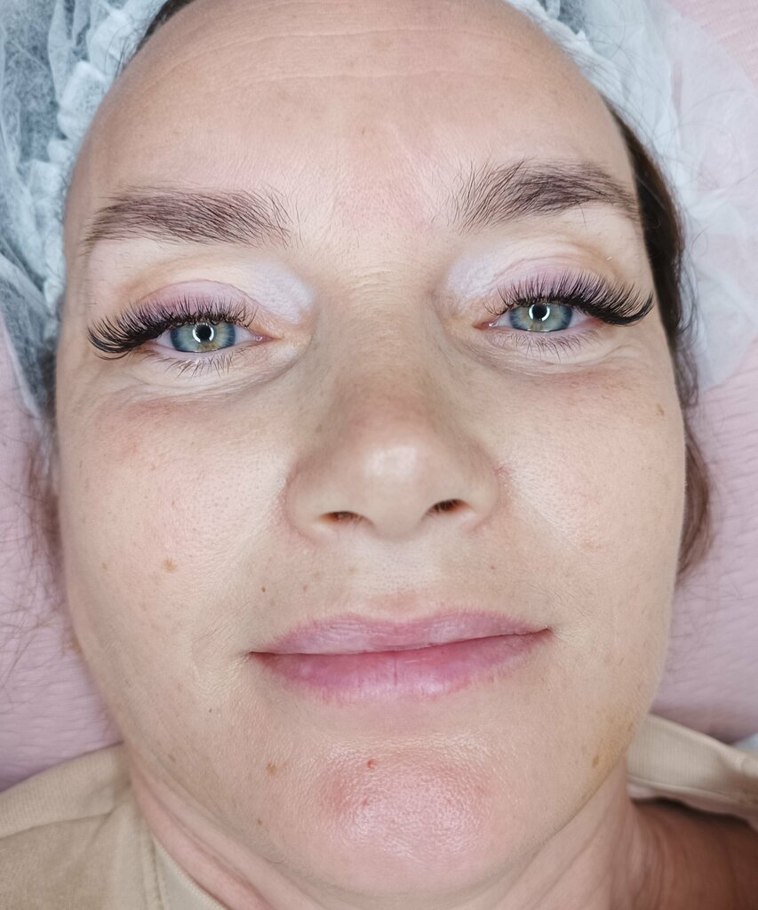 Kaş ve kirpik salonu Dr. Çağnur Özcanlı Dermatoloji ve Kozmetoloji Kliniği, Antalya, foto