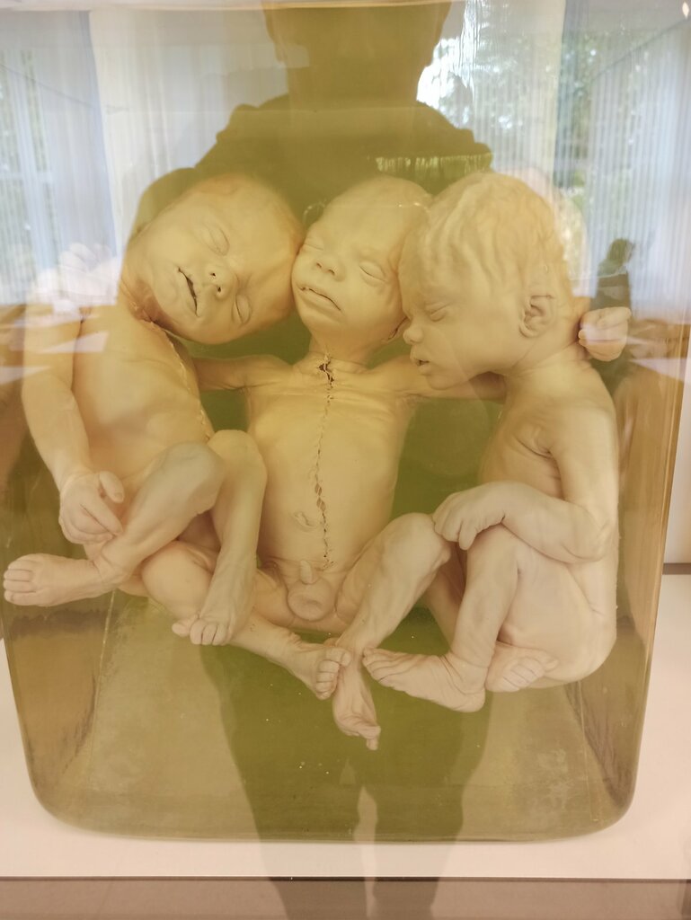 Müzeler ve sanat galerileri Anatomic exposition Hrodna Kunstkamera, Grodno, foto
