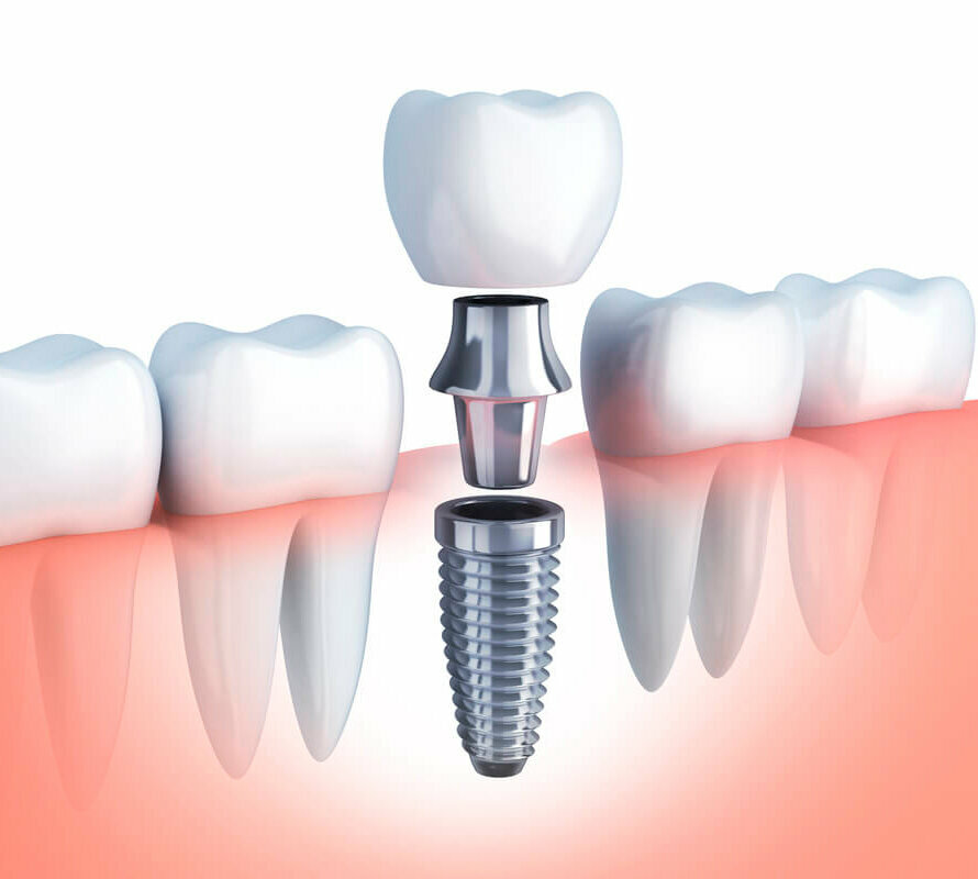 Diş sağlığı poliklinikleri Extra dental, Almatı, foto