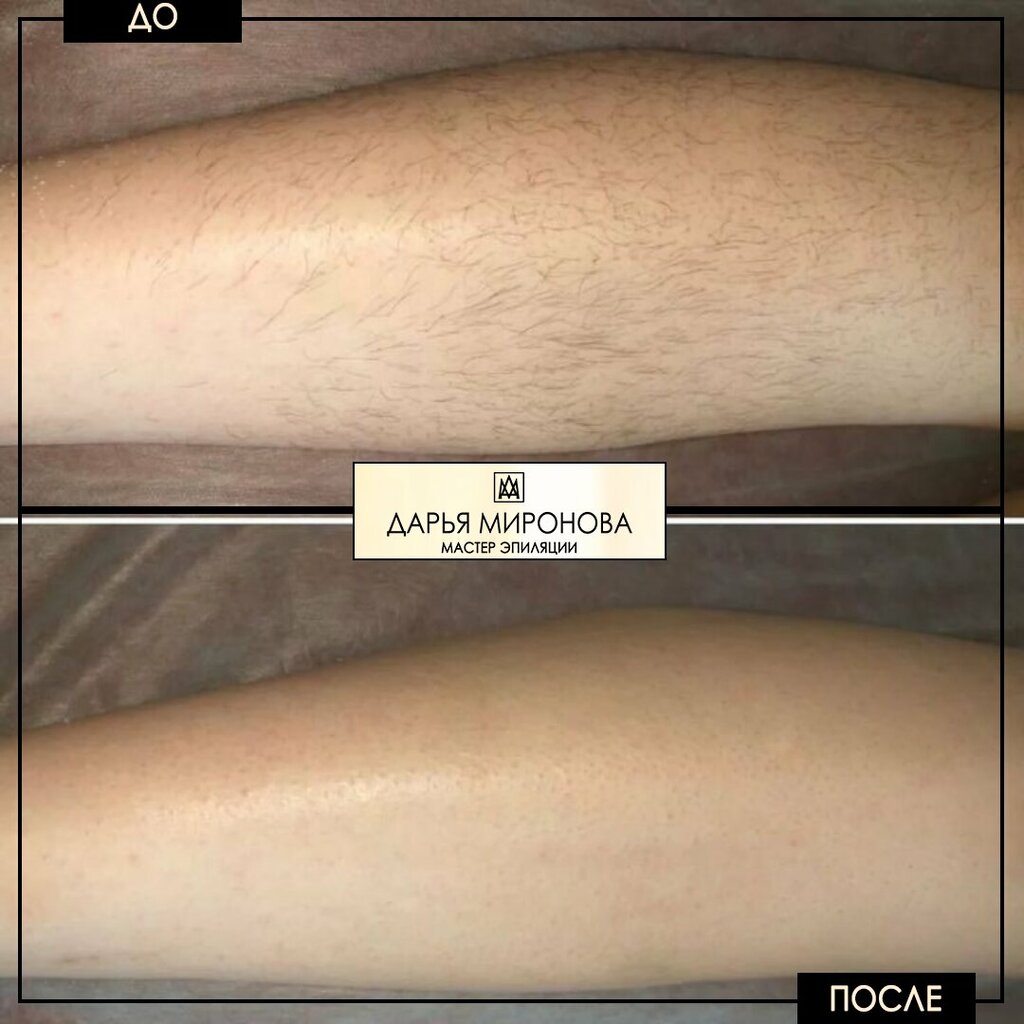 Epilasyon Эпиляция, Tiumen, foto